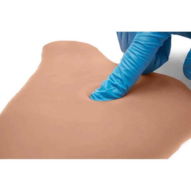 CAE Medicor Pitting Edema Sticky Pads 6 PC Mix Package | American ...